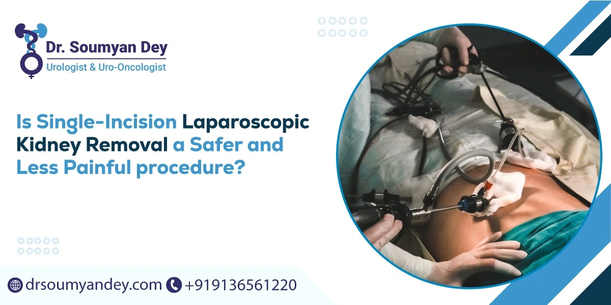 Is Single-Incision Laparoscopic Kidney Removal a Safer and Less Painful ...